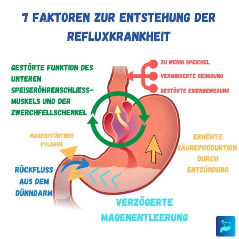 Elegantes Stiller Reflux Wann Besserung Bild