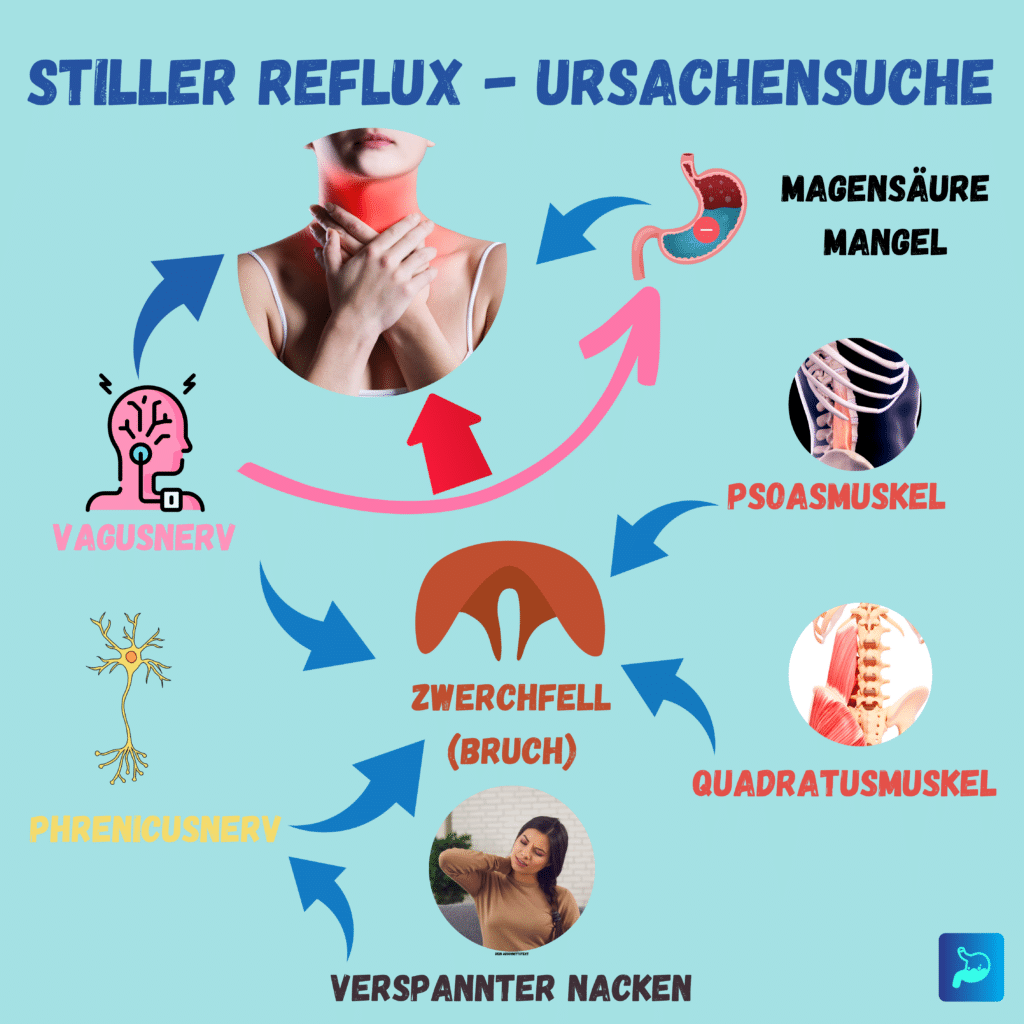 Was sind die Ursachen von Stillem Reflux?