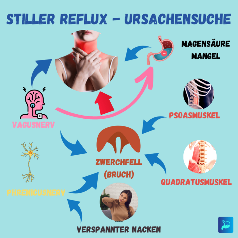 Was sind die Ursachen von Stillem Reflux?