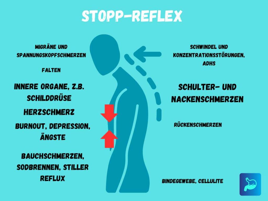 Stiller Reflux und sensomotorische Amnesie