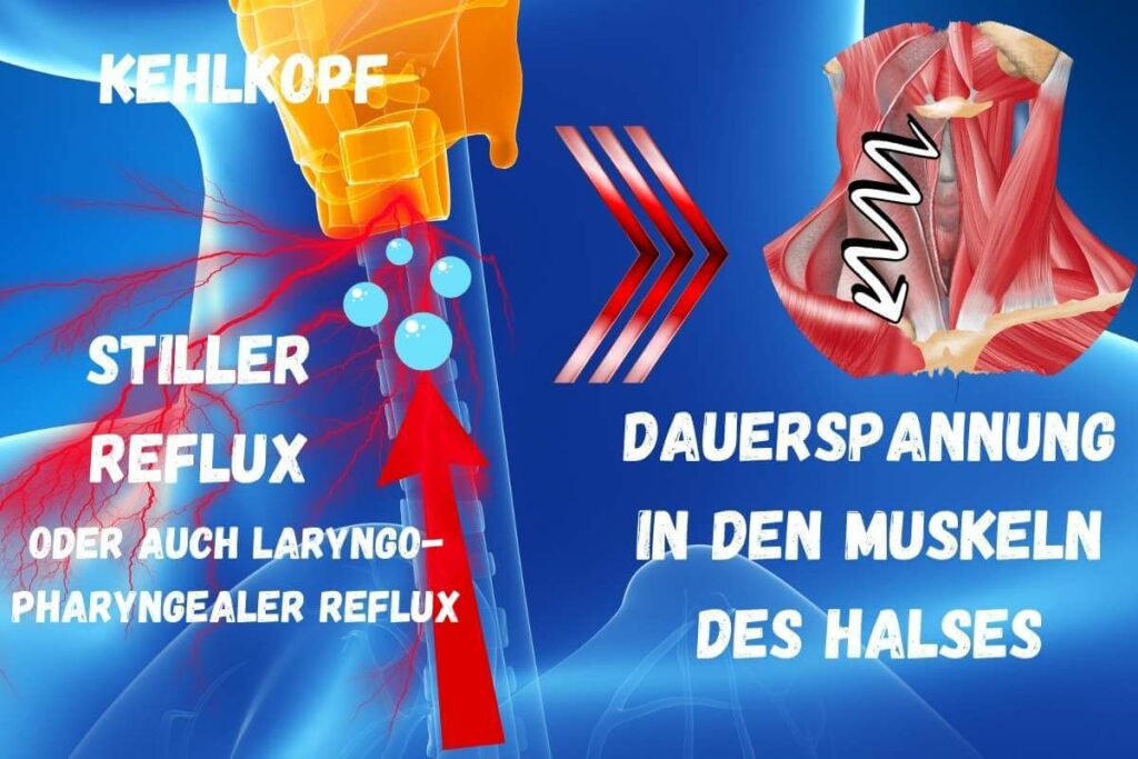 Stiller Reflux und verspannte Halsmuskeln